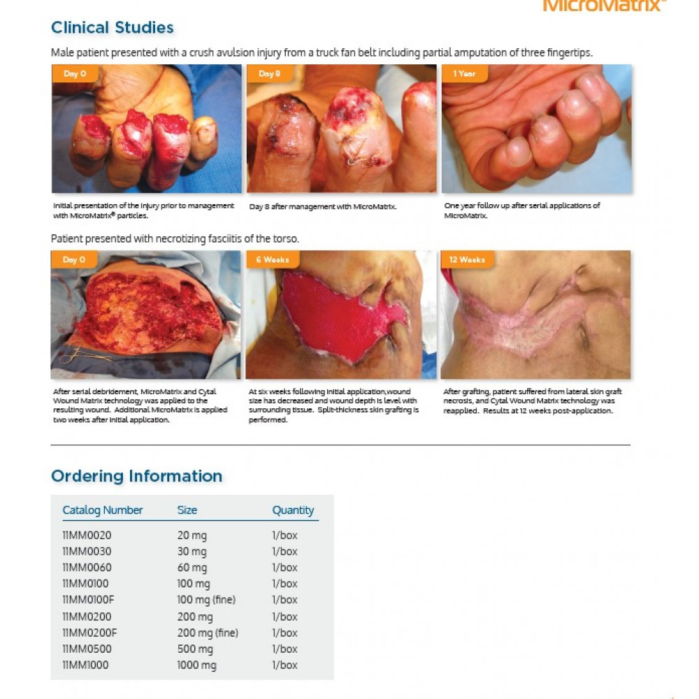 MicroMatrix® ACell’s wound management products