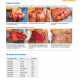 MicroMatrix® ACell’s wound management products